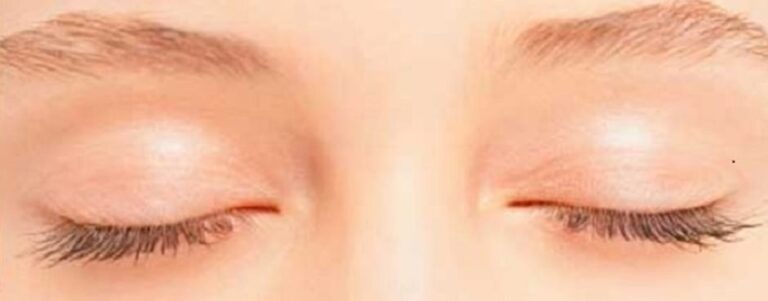 Blefarite occhio: cos'è e come si cura - Blog di Clinica Baviera Italia