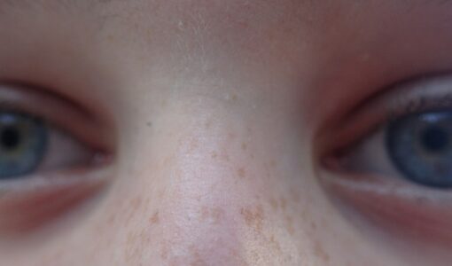 Visione Distorta: Quali Sono le Cause? - Blog di Clinica Baviera Italia