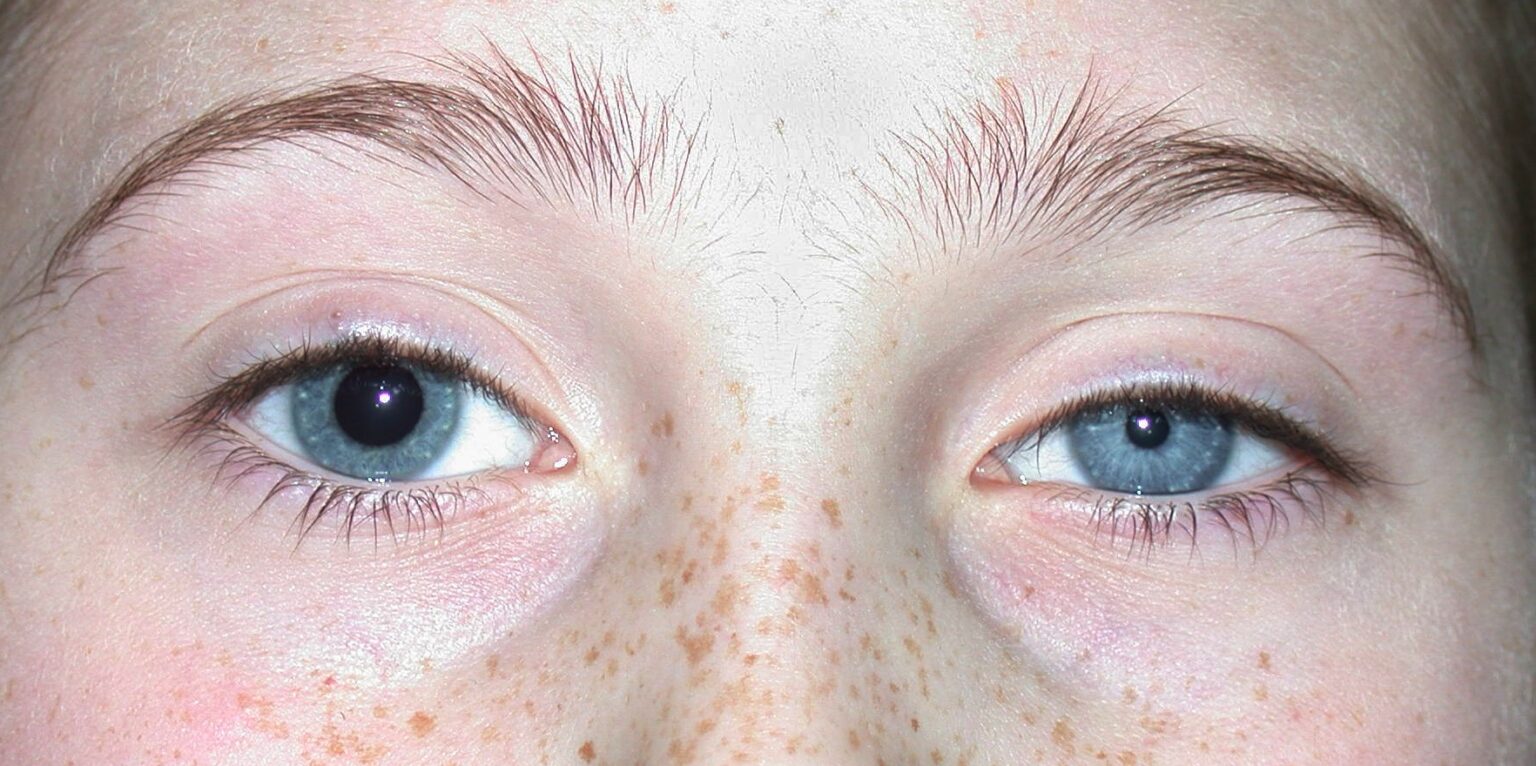 5 sintomi oculari da non ignorare - Blog di Clinica Baviera