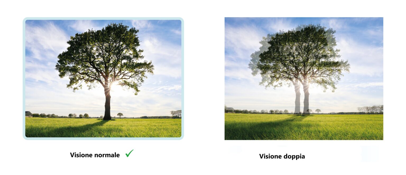 Diplopia, vedere doppio: cause e sintomi- Blog di Clinica Baviera Italia